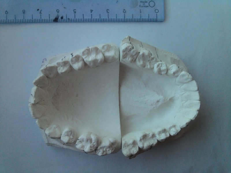 real world length measurement - AutoCAD Beginners' Area - AutoCAD Forums